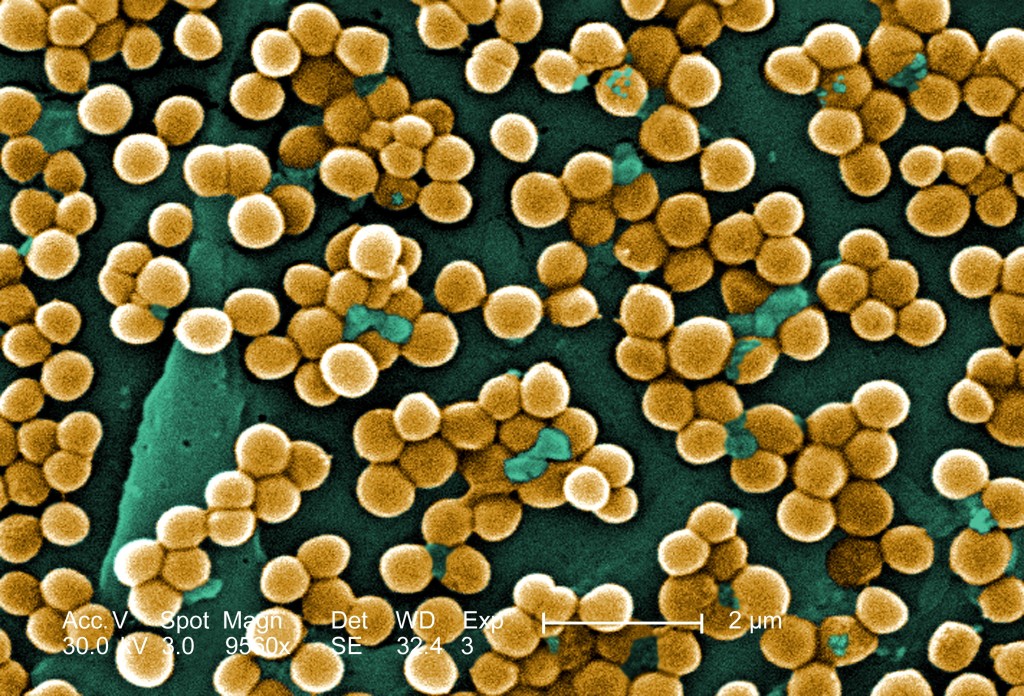 MRSA - Quip Labs